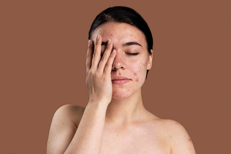 6 Adult Skin Problems You Must Know About That - Learnloftblog